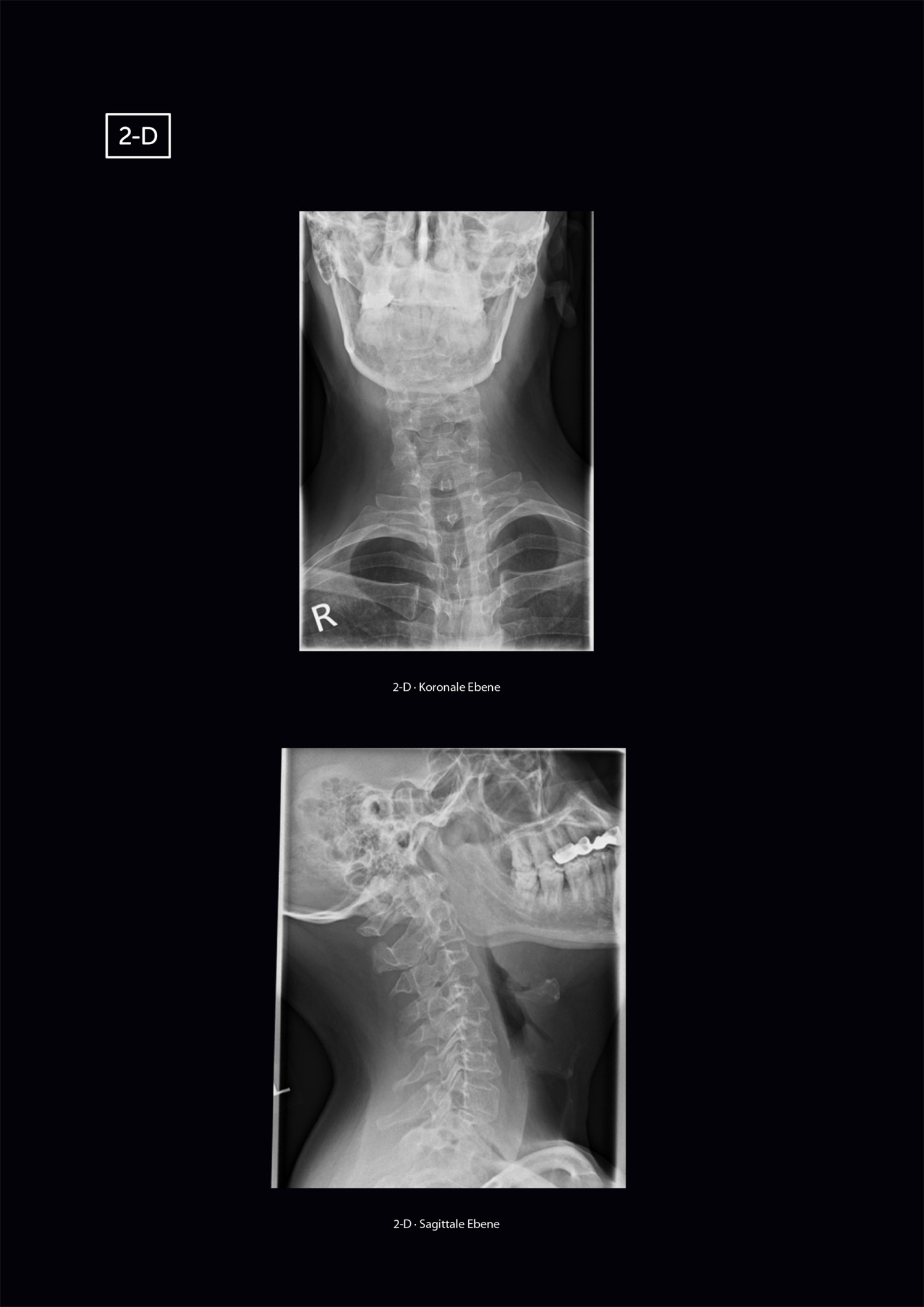 Die SCS Bildgebung in der HWS-Diagnostik – BVOU Netzwerk