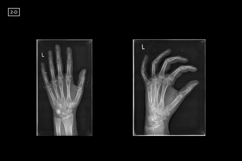 Perspektive DVT – Die SCS Bildgebung als Primärdiagnostik – BVOU Netzwerk