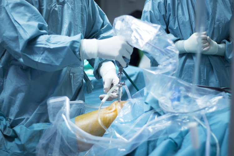 Kongress thematisiert postoperative Wundinfektionen – BVOU Netzwerk