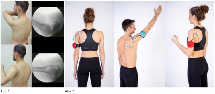 Das Shoulder Pacemaker Therapiekonzept zur Behandlung der funktionellen hinteren ...