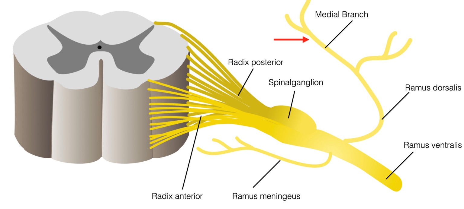 Die neue Leitlinie Radiofrequenz-Denervation der Wirbelsäule – BVOU ...