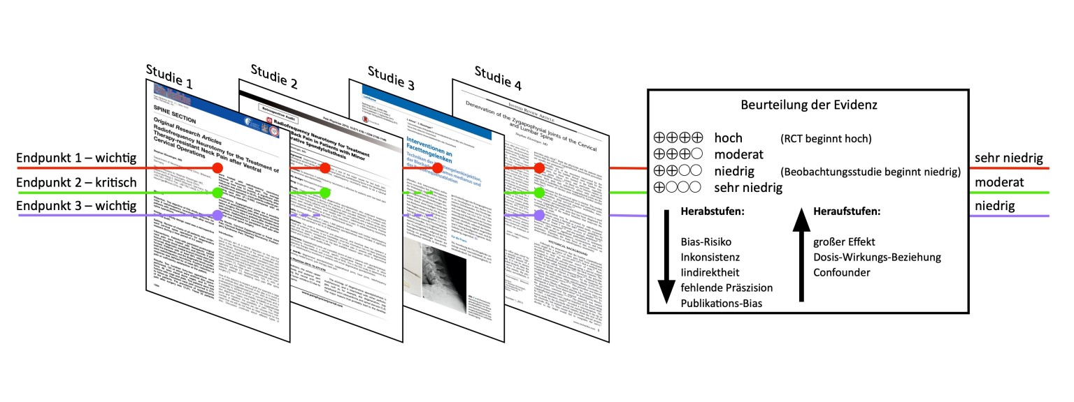 Die neue Leitlinie Radiofrequenz-Denervation der Wirbelsäule – BVOU Netzwerk